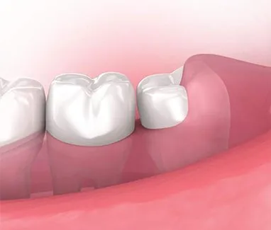 Oral Surgeon Winston-Salem | Oral Surgery